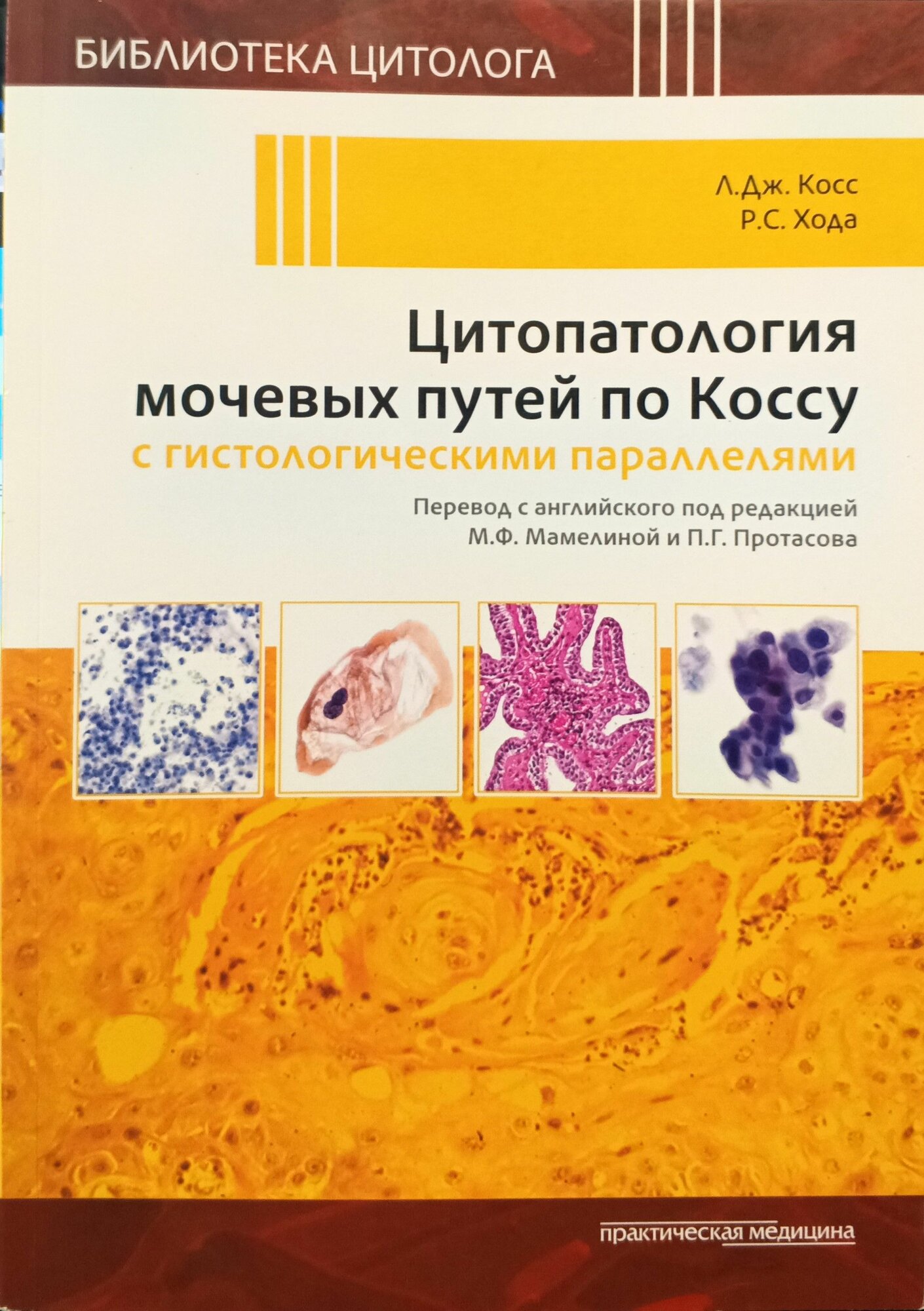 Цитопатология мочевых путей по Коссу с гистологическими параллелями. Л. Дж. Косс.