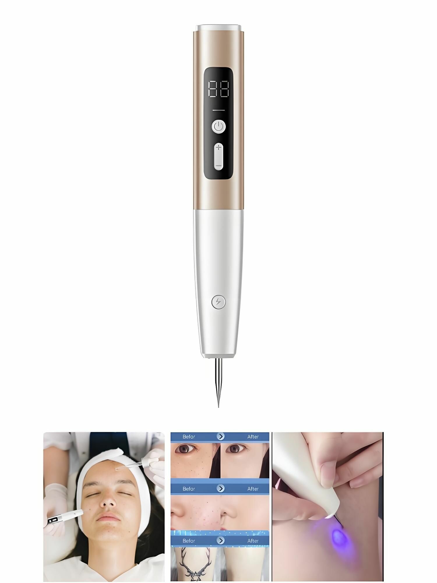 Лазерная ручка для удаления родинок, веснушек, черных точек, бородавок, прыщей, тату, цвет серебро