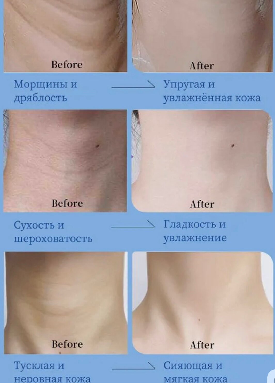 Маска для шеи против морщин, увлажнение и питание . Замедление старения , упругость кожи. 10 штук