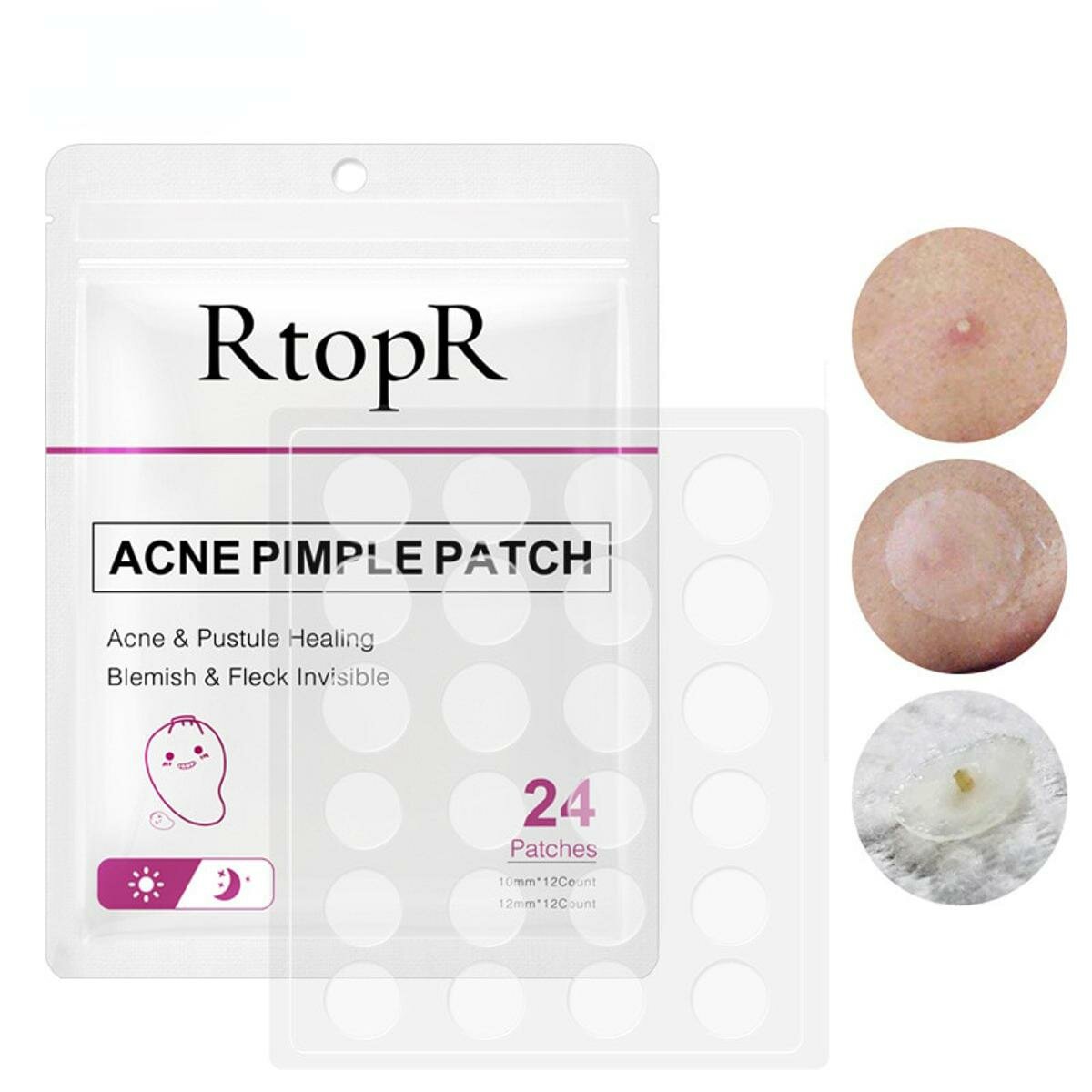 Пластырь от прыщей от угрей Невидимые наклейки от прыщей - средство для лечения пятен Мастер-средство от прыщей Уход за кожей Маска для лица Средства для красоты