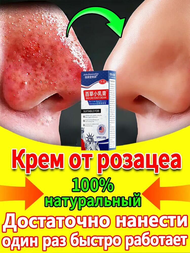 Крем от покраснений, розацеа, купероза и сосудистых звездочек для точечного , 20мл