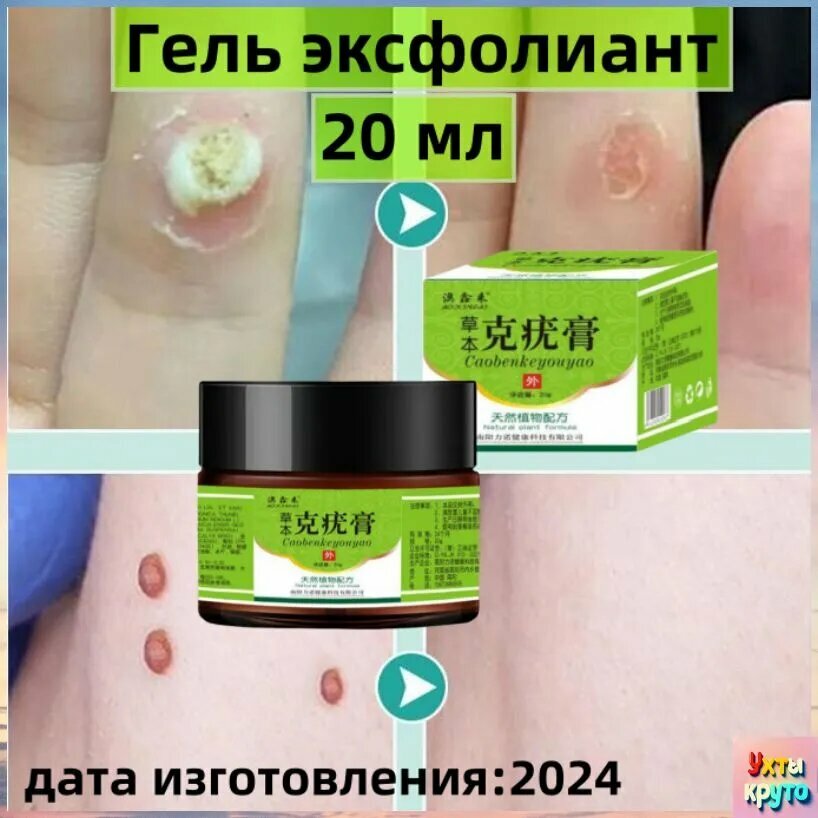 Гель эксфолиант Клареол, для удаления родинок и пигментных пятен, 20мл