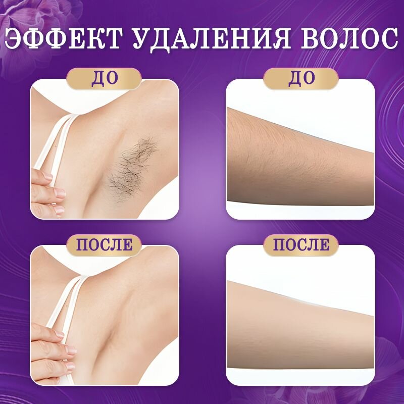 Фотоэпилятор для удаления волос С режимом охлаждения BHRL-07