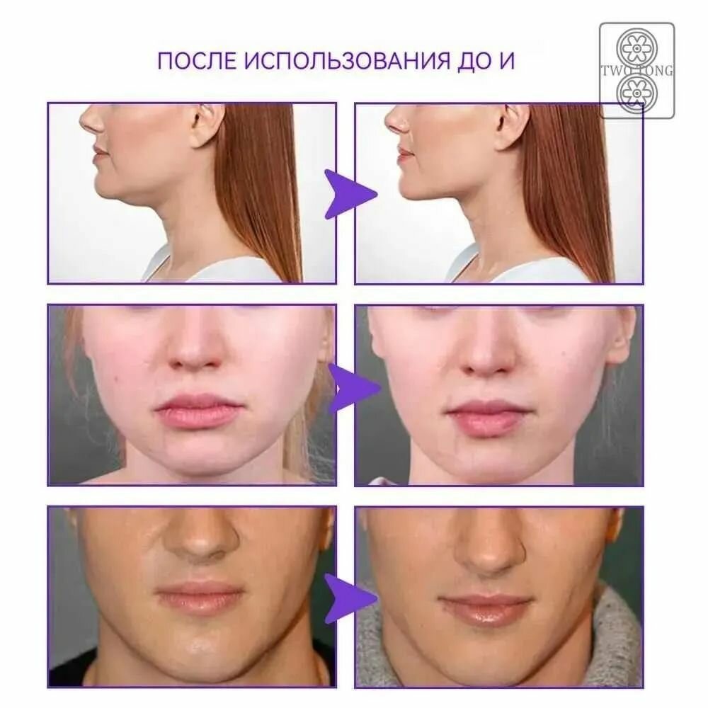 Крем для похудения с подтяжкой лица, укрепляющий V-образный массажер для мышц, двойной подбородок, средства для сжигания жира на лице, антивозрастные средства