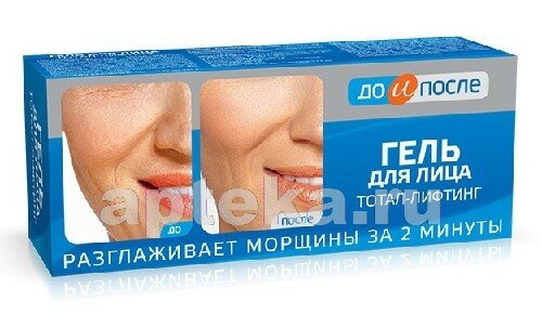 До и после гель для лица тотал-лифтинг 50 мл