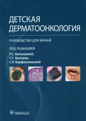 Детская дерматоонкология : руководство для врачей