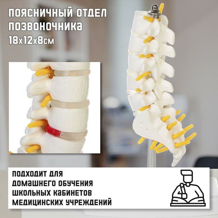 Анатомический макет Поясничный отдел позвоночника, 18×12×8 см