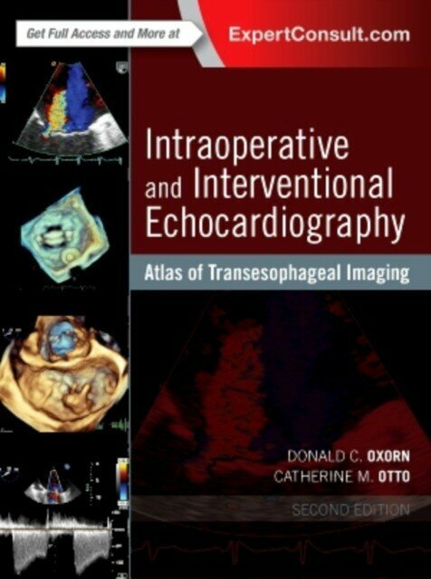 Oxorn Donald "Intraoperative and Interventional Echocardiography"