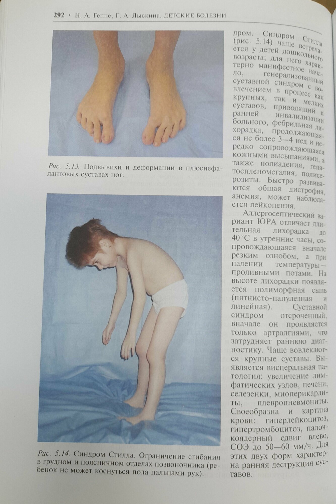 Детские болезни — фото 1