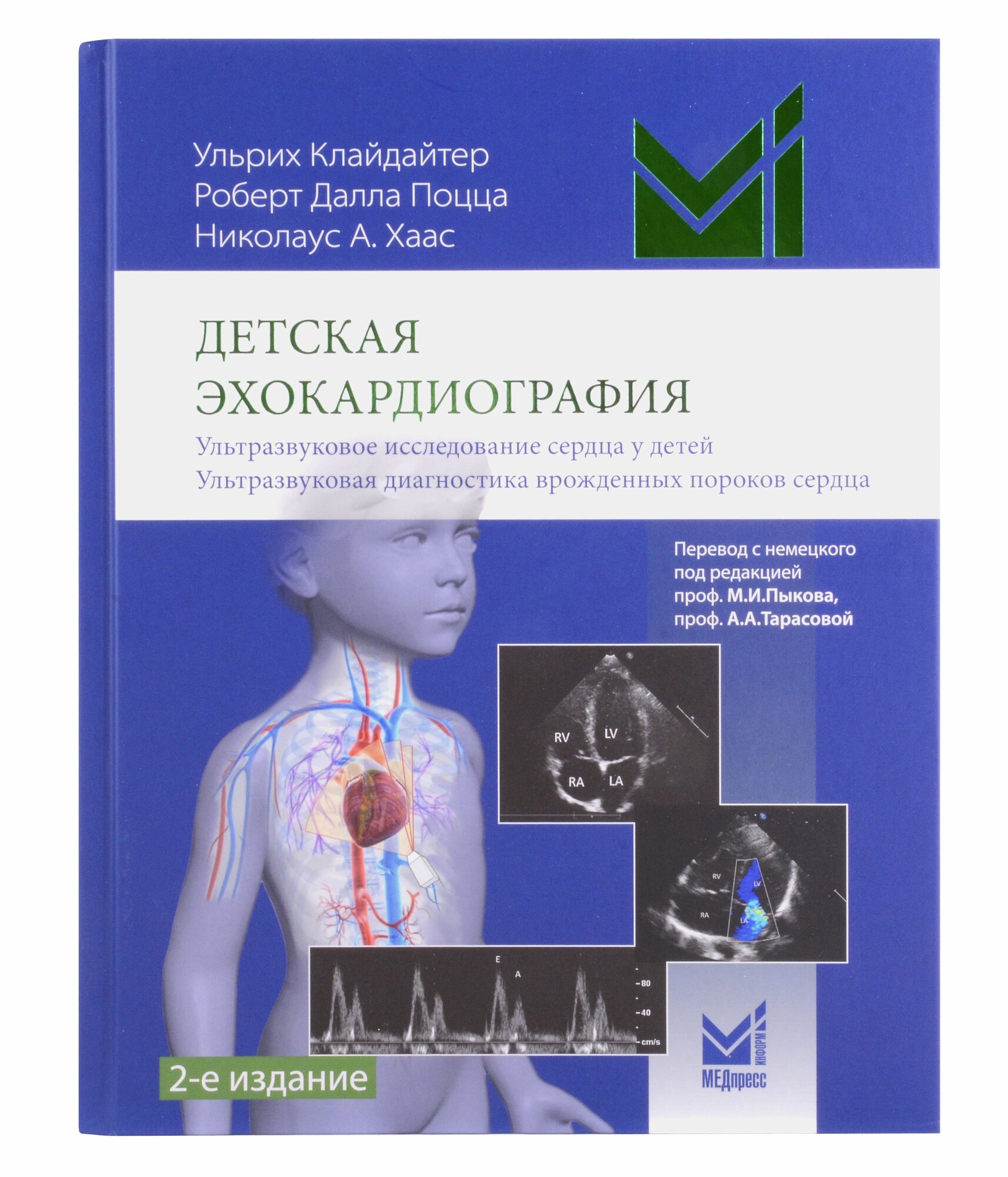 Детская эхокардиография