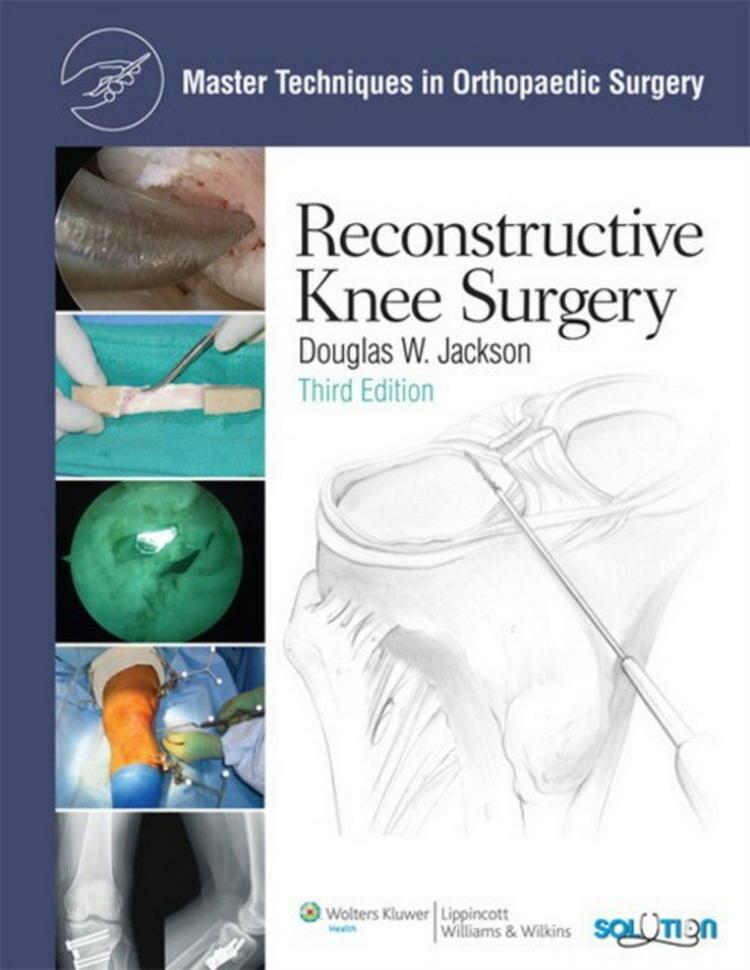 Mtos: recon knee surgery 3e cb