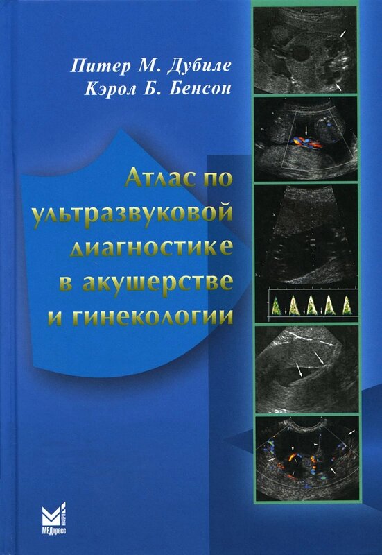 Атлас по ультразвуковой диагностике в акушерстве и гинекологии. 4-е изд (Дубиле П, Бенсон К. Б.)