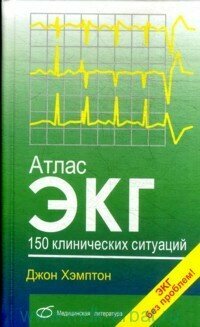 Книга "Атлас ЭКГ : 150 клинических ситуаций"