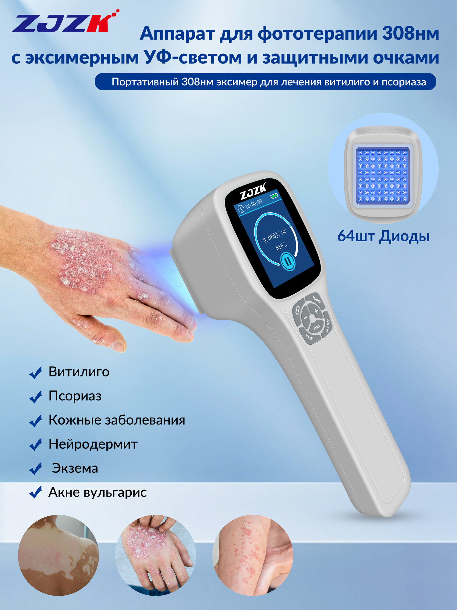 Эксимерный UVB 308 нм точечный лазер безопасный для дома витилиго псориаз экzema
