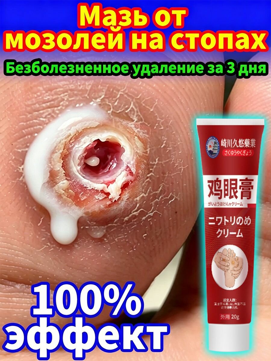 Мазь от стержневых мозолей на ногах смягчение и уход