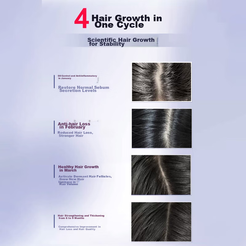 WayourCare Electric Laser Hair Growth Cap, Hair Thickening And Oil Control Helmet, Special Anti-Balding Device, Hair Growth Instrument, Hair Comb