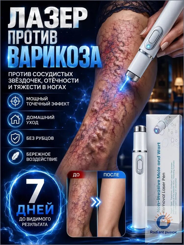 Лазерный прибор от варикоза и сосудистых патологий снимает отёки, усталость, борется с тромбозом и звёздочками, 1 шт.