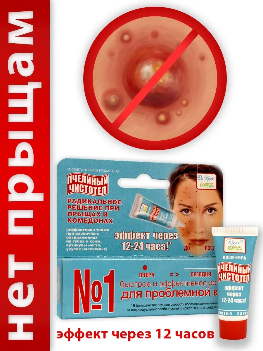 Крем-гель "Пчелиный чистотел", от прыщей акне, против угрей для проблемной кожи 10 мл