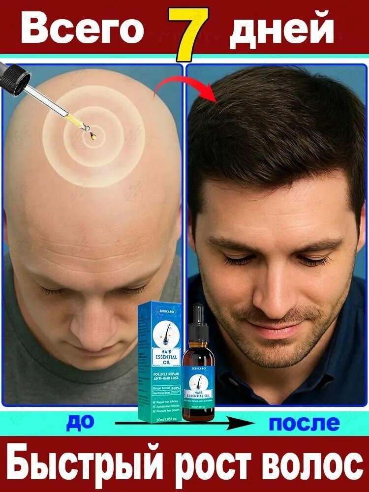 Масло для волос, бровей, ресниц и бороды, для роста и восстановления, против выпадения, 300 мл