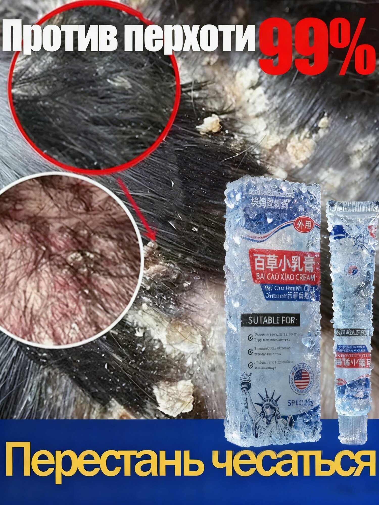 Крем от псориазадля лечения себорейного дерматита, зуда кожи и других кожных заболеваний, для кожи головы, тела и лица, 20 г