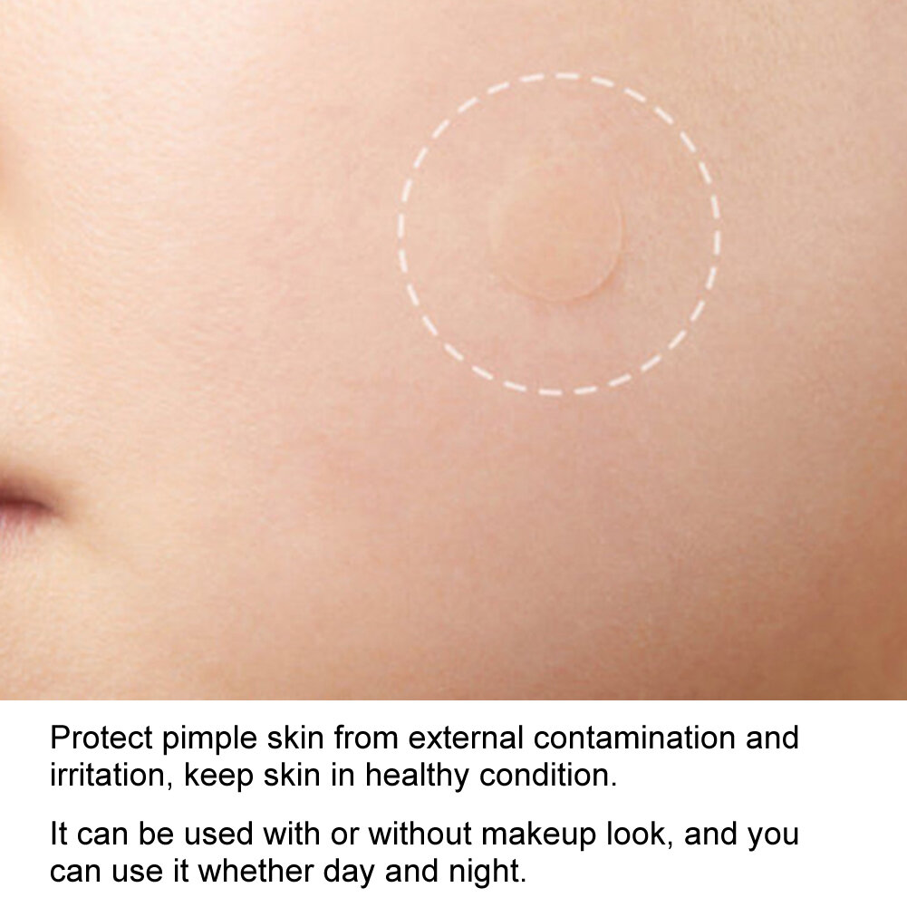 36pcs/Sheet Пластыри для прыщей из гидроколлоида Прозрачные Пластыри для скрытия прыщей Размеры 8mm (24шт) и 12mm (12шт) Материал гидроколлоид Клейкий Пластырь для прыщей