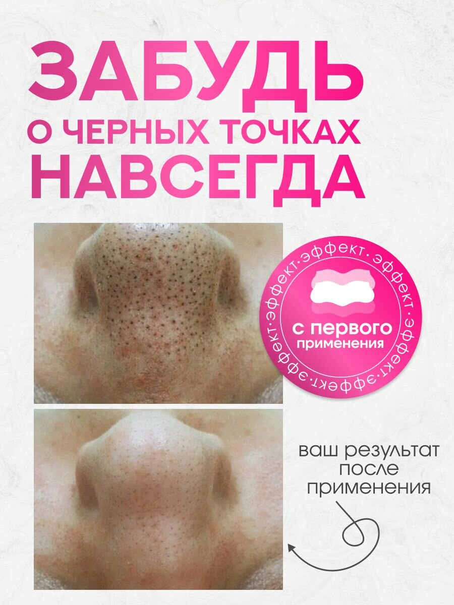 Патчи от черных точек для носа — фото 1