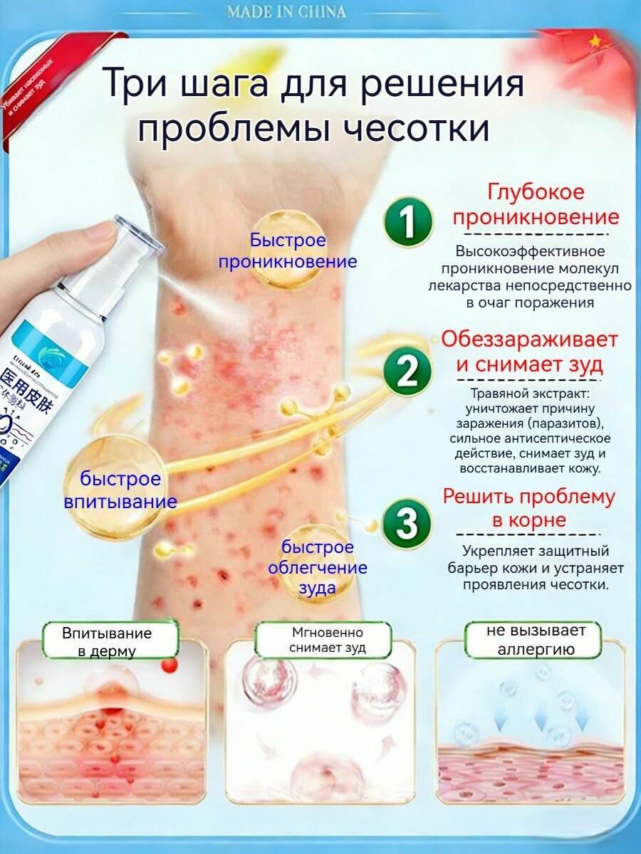 Спрей от чесотки и прыщей на теле Устраняет зуд, сыпь и раздражение кожи, лечит акне на спине и теле