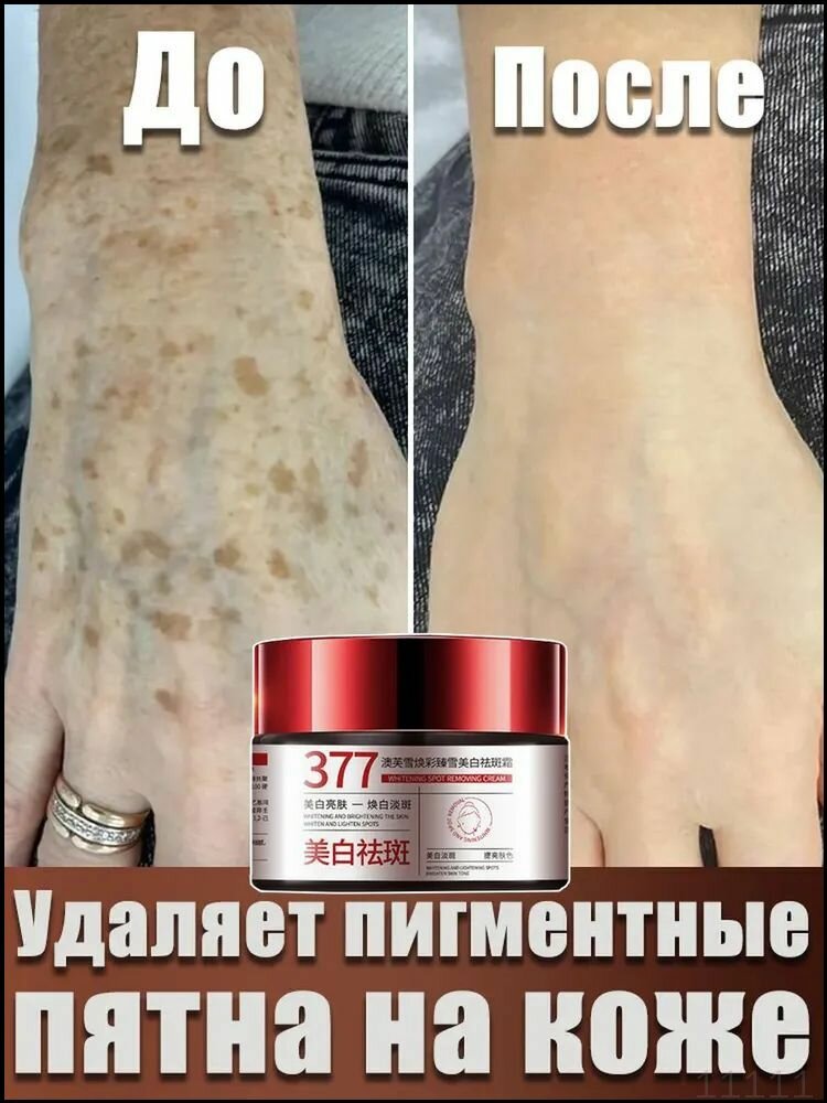 Популярный крем для мужчин и женщин против пигментации, осветляющий и удаляющий пигментные пятна на лице, 30 г