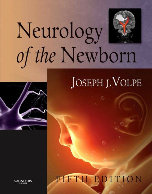 Joseph Volpe "Neurology of the Newborn"