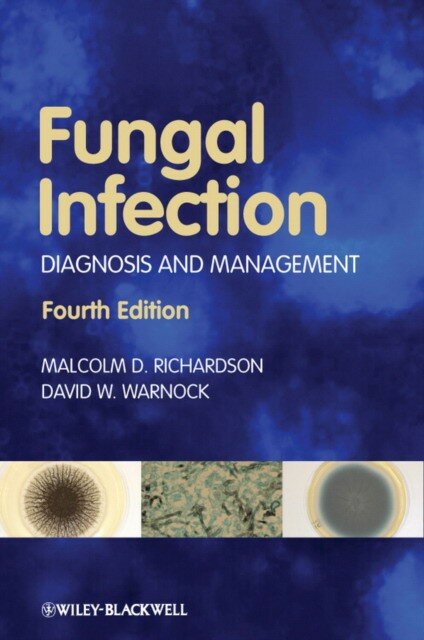 Richardson "Fungal Infection: Diagnosis and Management, 4th Edition"