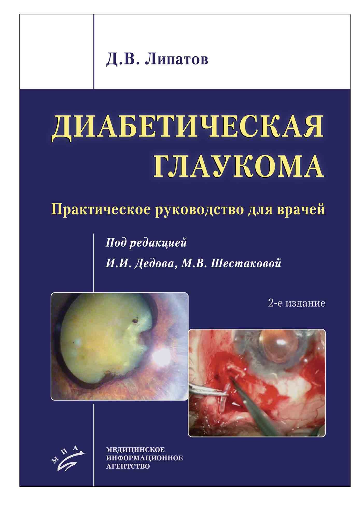 Диабетическая глаукома. Практическое руководство для врачей