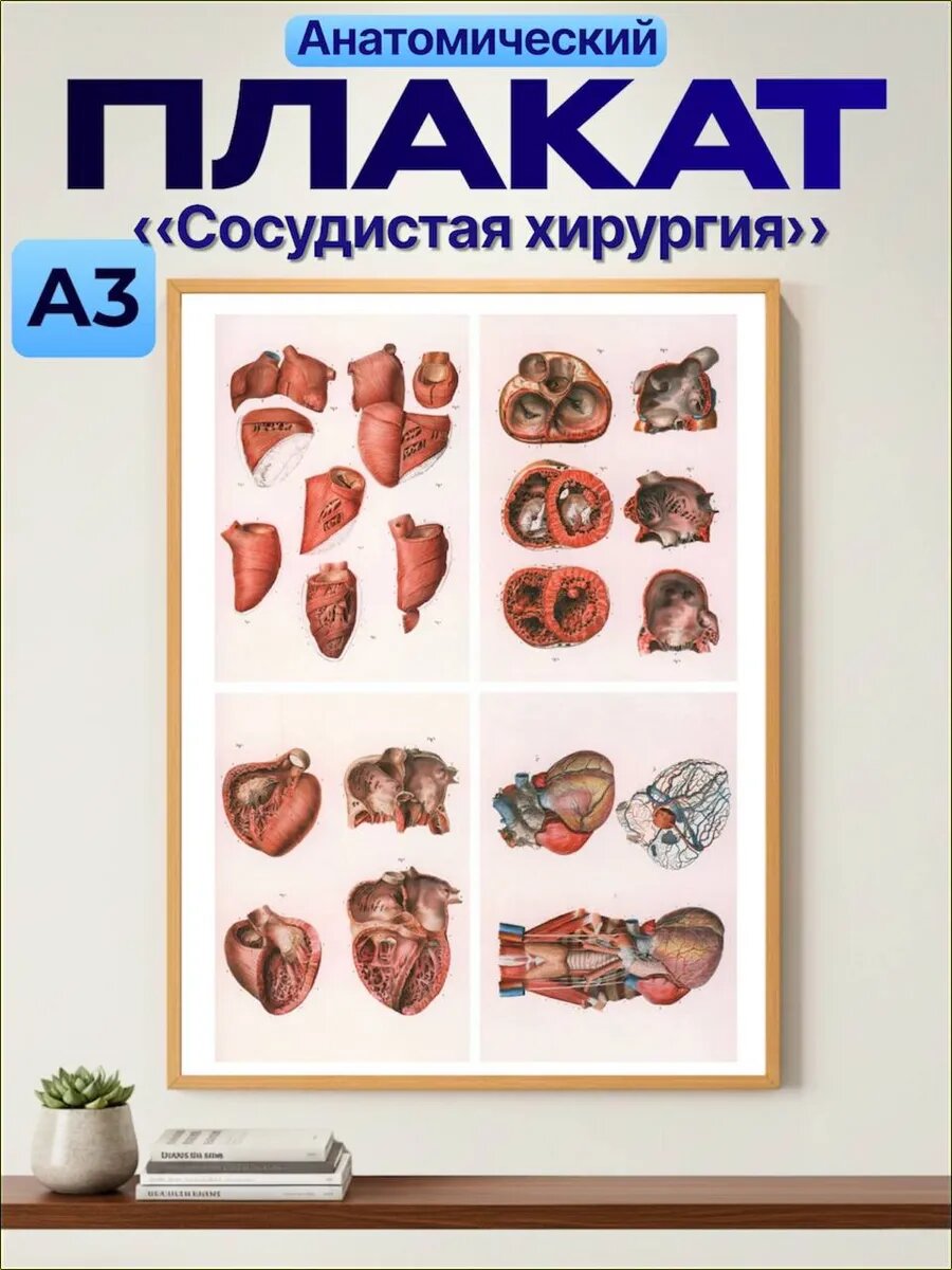 Постер медицинский, клапаны, сосудистая хирургия, А3 анатомия, хирургия