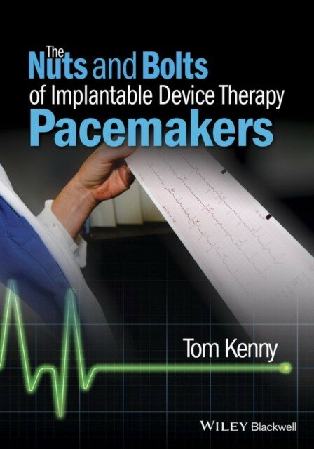 Tom Kenny "The Nuts and Bolts of Implantable Device Therapy: Pacemakers"