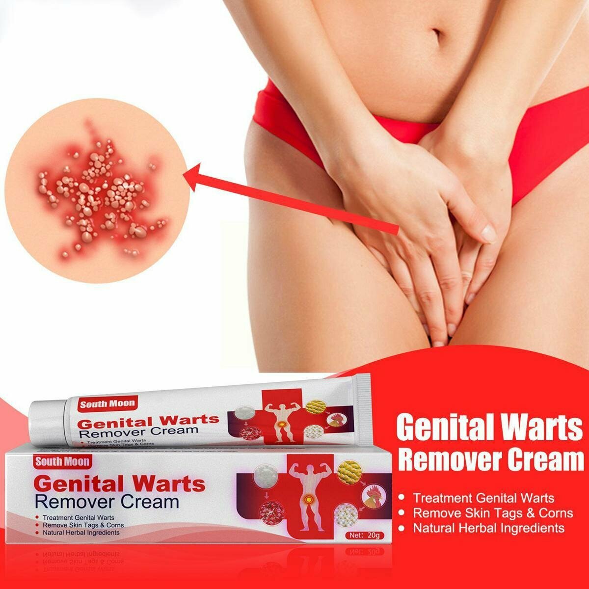 Мазь для удаления бородавок при генитальном герпесе, крем для лечения родинок на коже, уход за кожей Acuminatum O9F2