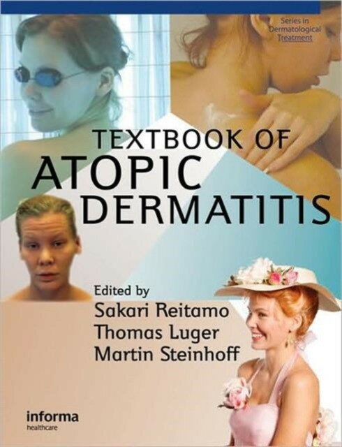 Reitamo "Textbook Atopic Dermatitis"