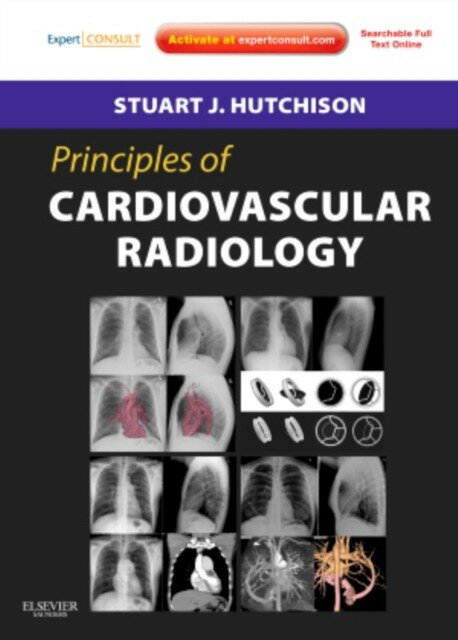 Stuart J. Hutchison "Principles of Cardiovascular Radiology,"