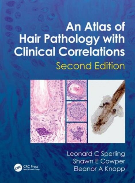 Leonard C. Sperling "An Atlas of Hair Pathology with Clinical Correlations, 2 Ed."