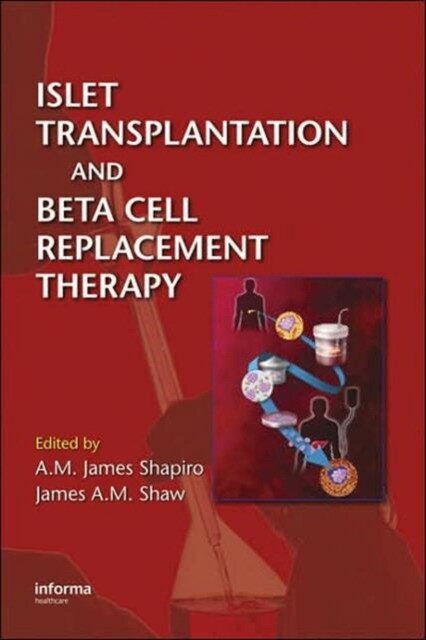 A. M. James Shapiro "Islet transplantation and beta cell replacement therapy /"