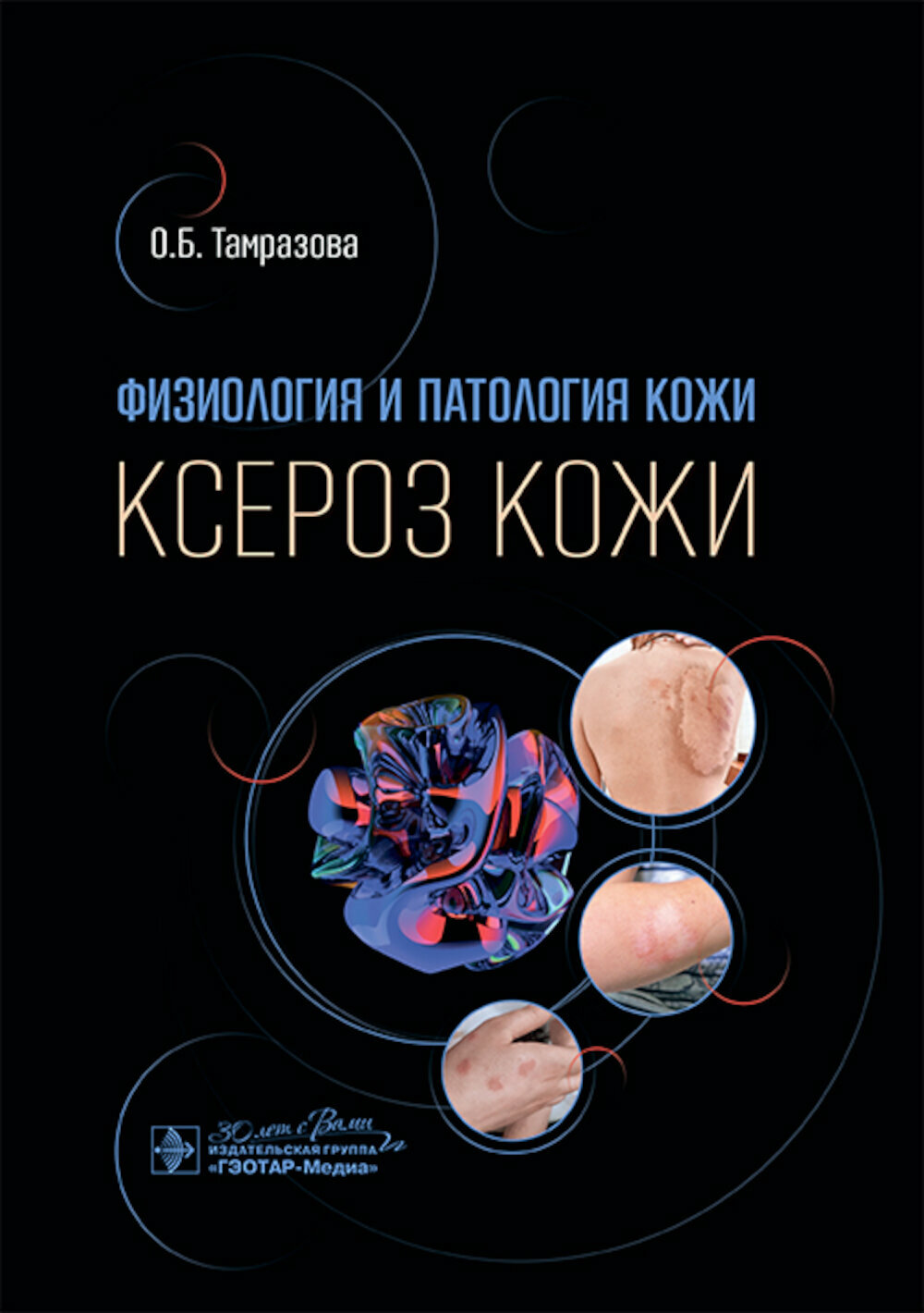 Физиология и патология кожи. Ксероз кожи. Тамразова О. Б. Гэотар-медиа