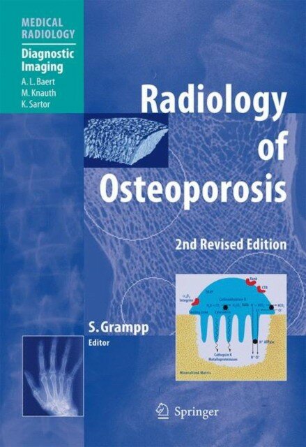 Grampp "Radiology of Osteoporosis"