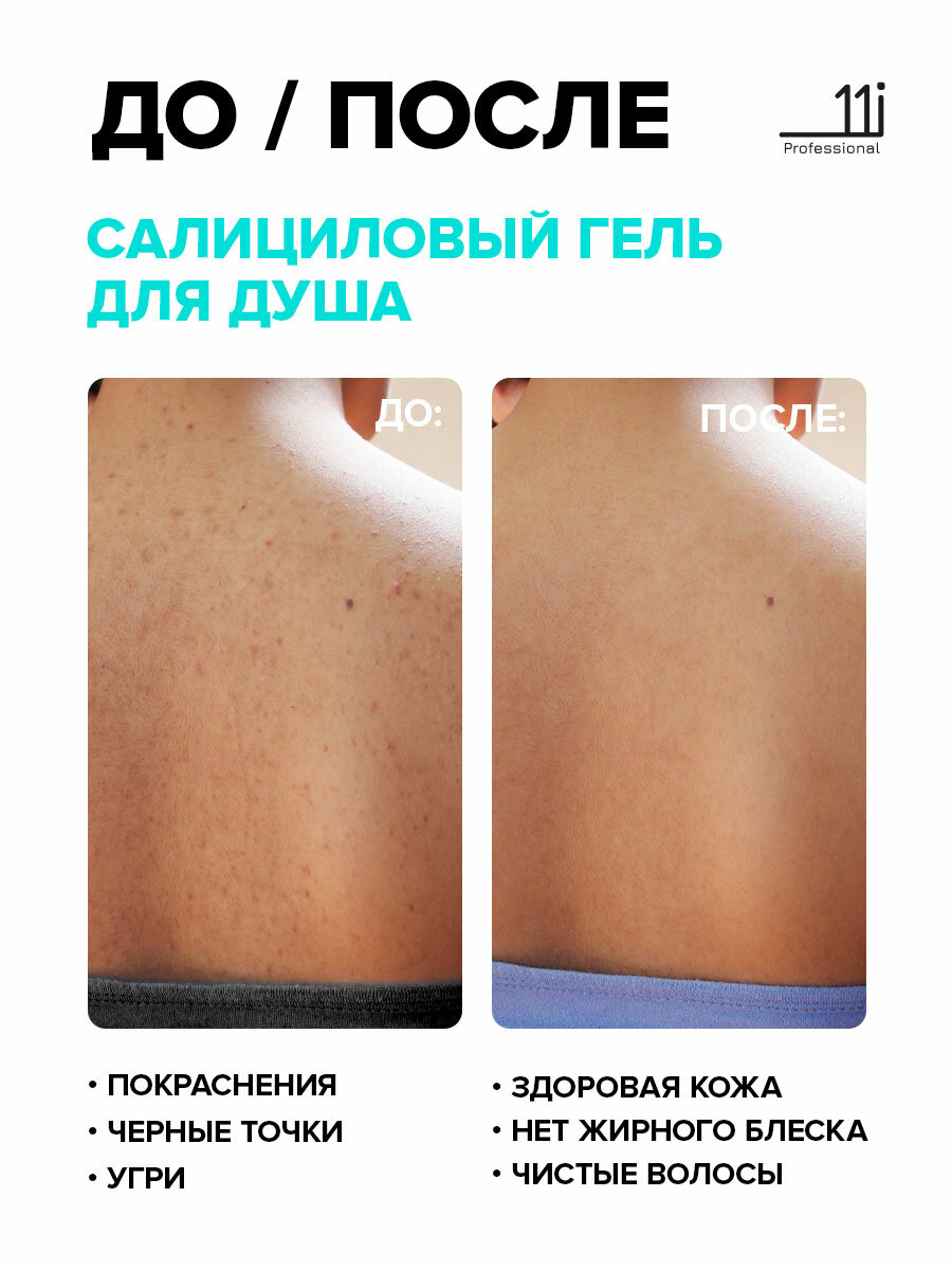 Гель для душа парфюмированный с кислотами от прыщей. Очищающий, увлажняющий. 250 мл