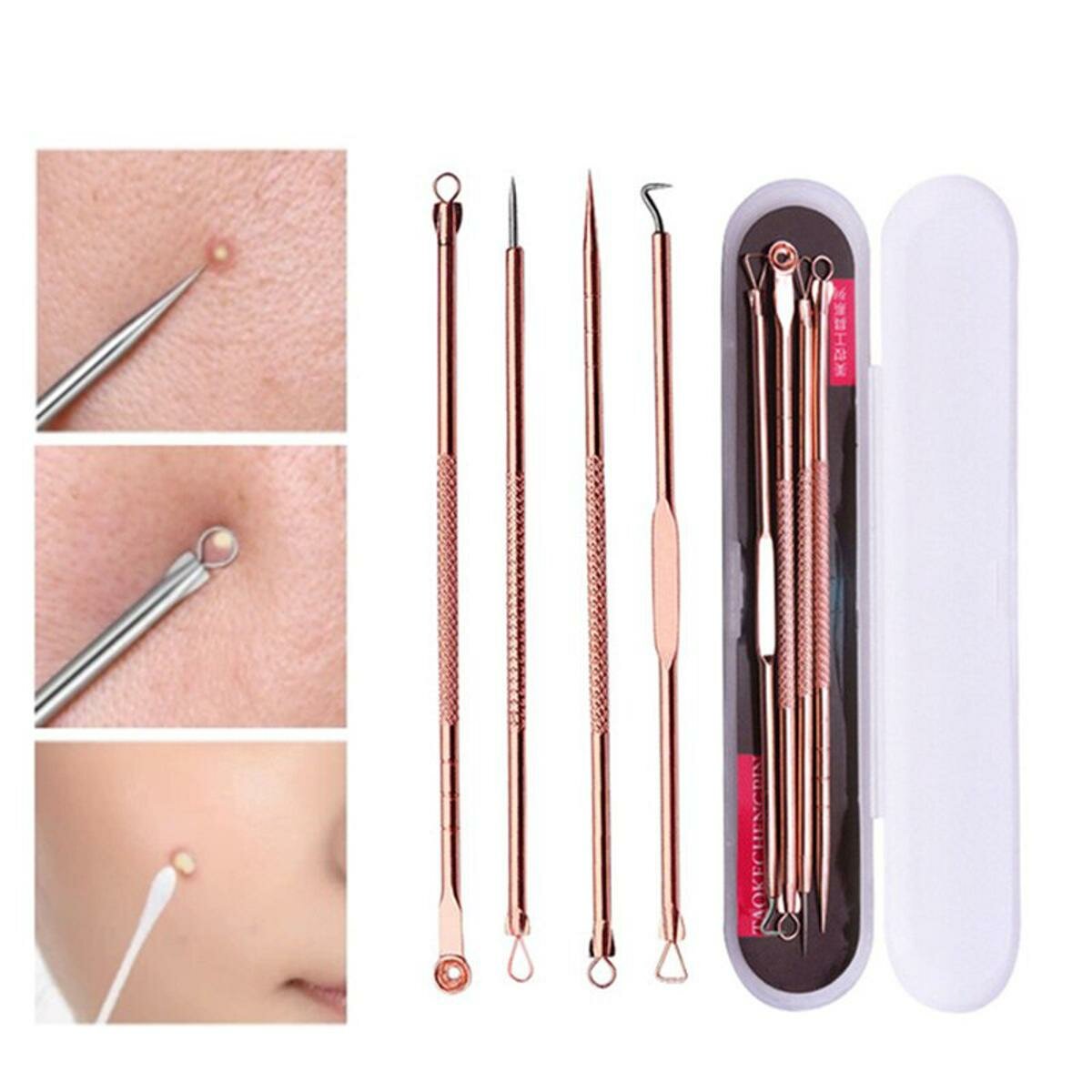 Набор для удаления черных точек, набор игл от прыщей, инструмент для чистки носа, лица, прыщей и черных точек, лечение пятен, выскакивание белых угрей
