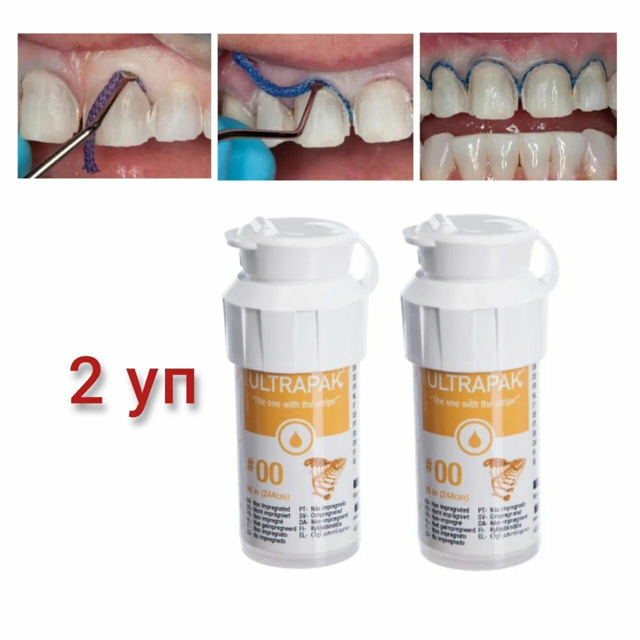 Набор 2 уп, нить ретракционная ULTRAPAK (ультрапак) #00 (244 см) Десневая Стоматологическая. №00 (желтая) от NeoHealth