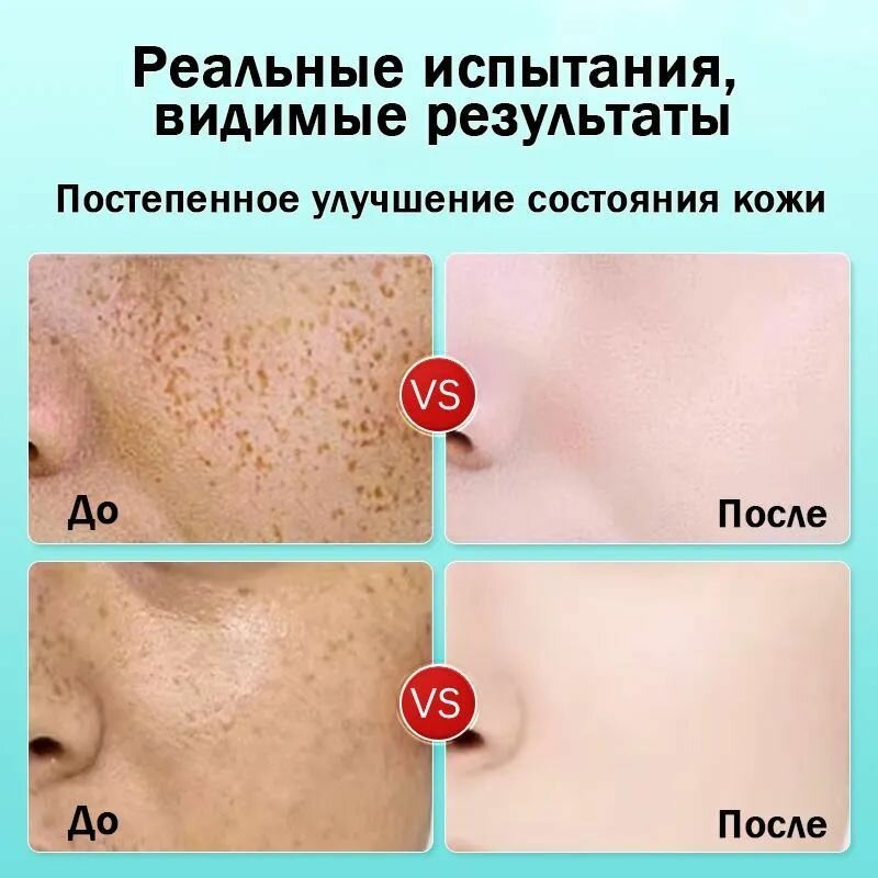 Сыворотка для лица — фото 1