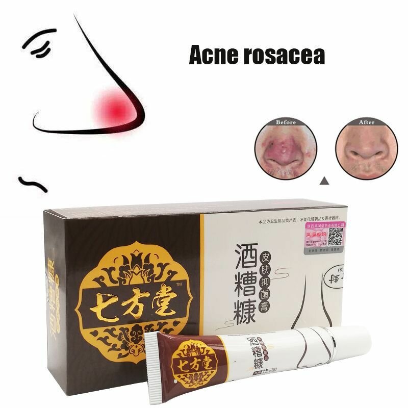 Мазь от розацеа, уход за лицом, 15 г.