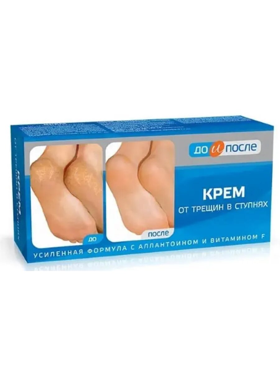 Крем для ног "До и После", от трещин и натоптышей, для сухой кожи, 150мл
