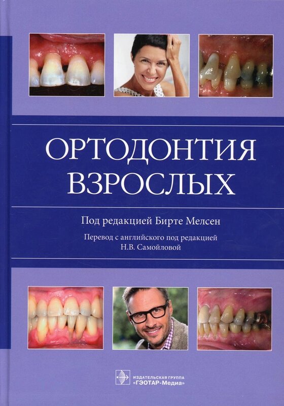 Ортодонтия взрослых (Под ред. Мелсен Б.)