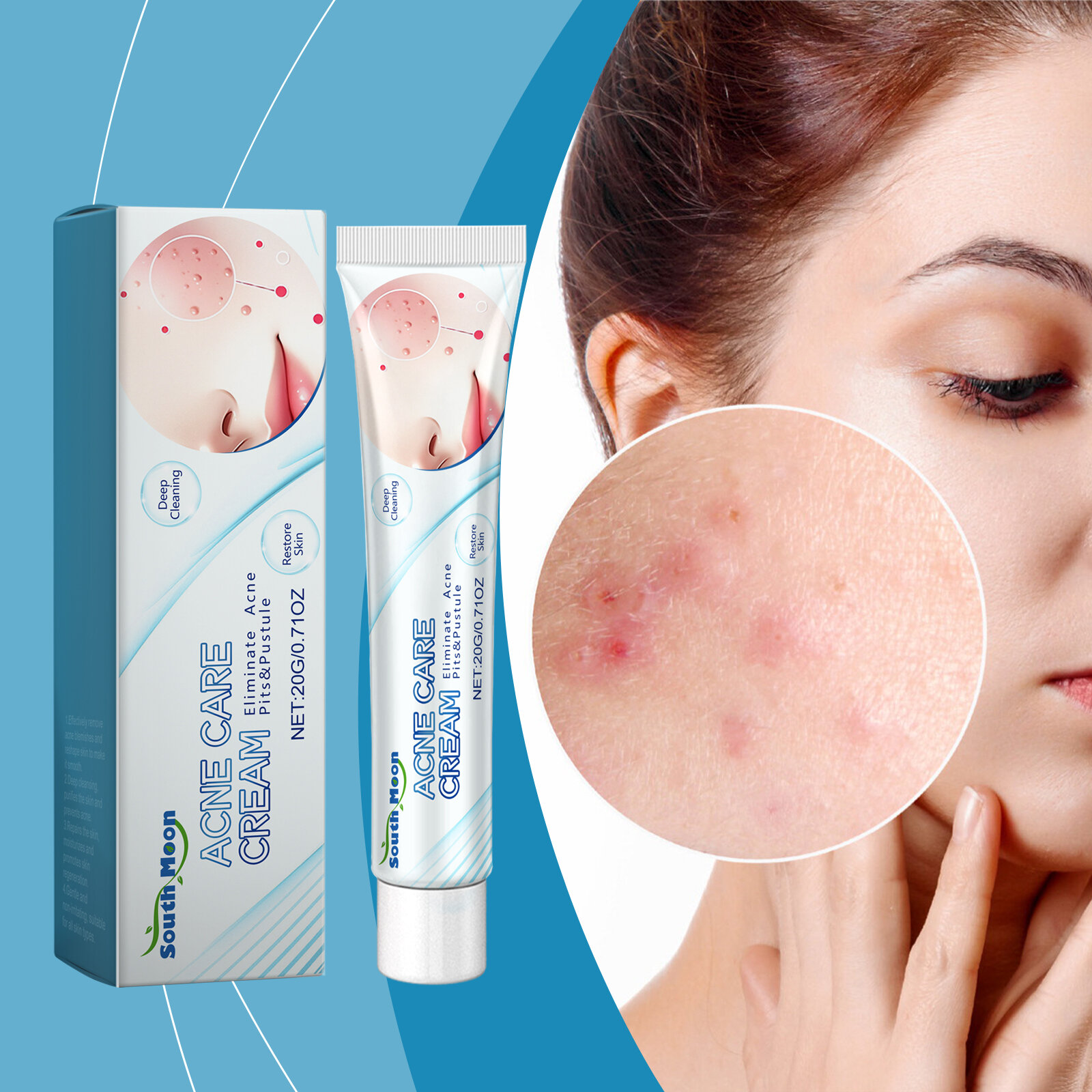 Крем для устранения прыщей, шрамов от угревой сыпи, улучшающий очищение кожи от прыщей, крем от закрытых комедонов