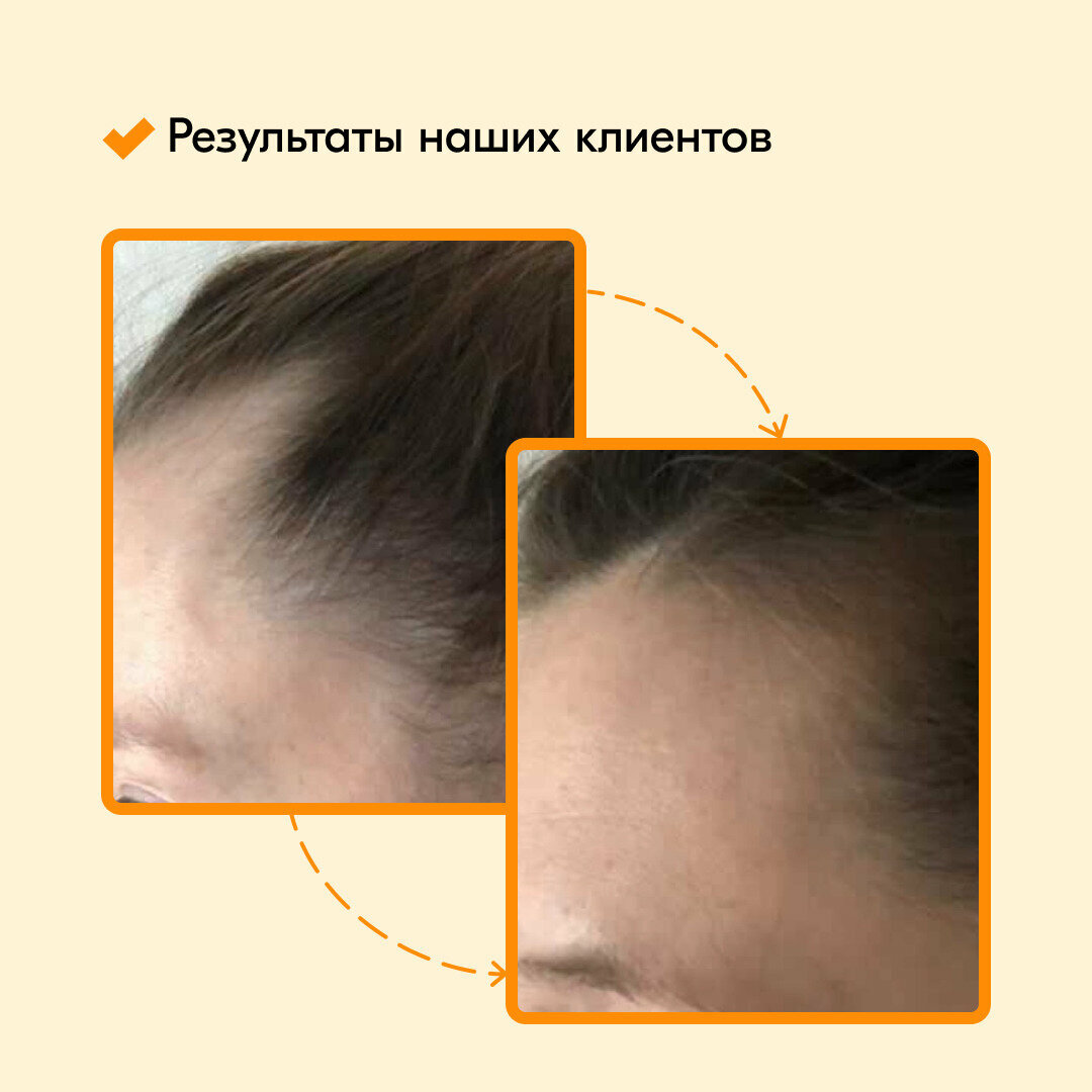 Лосьон Zhangguang 101B Hair Tonic для роста и укрепления волос против выпадения для мужчин и женщин