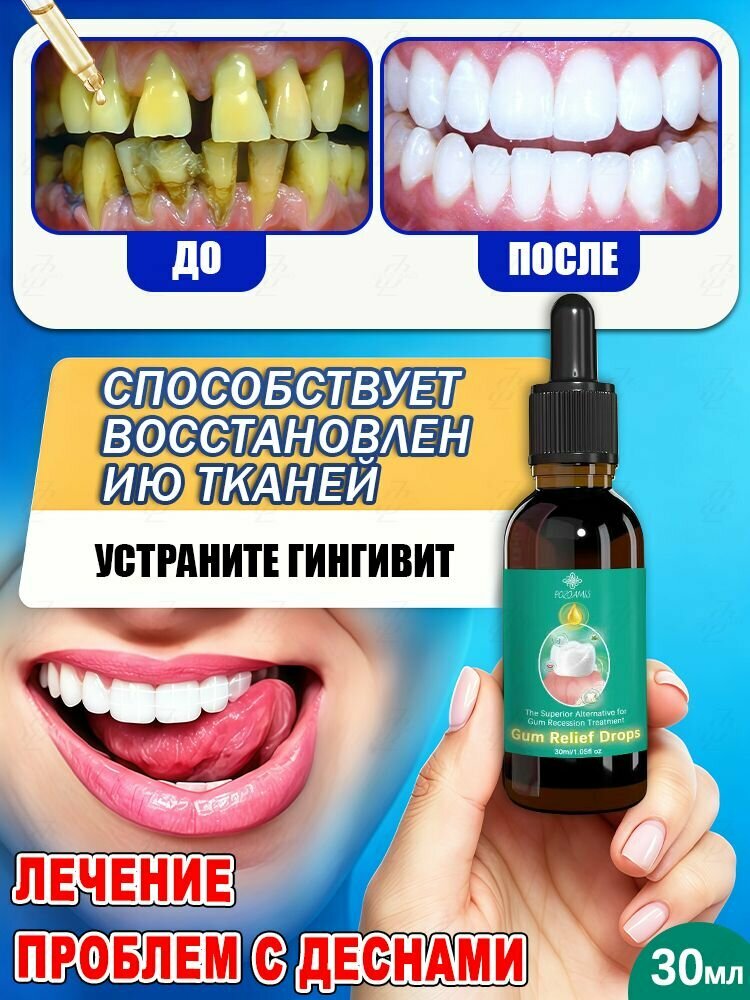 Капли для успокоения десен, снимают отек и боль в деснах, против кровоточивости, восстановление пародонта,47 г.